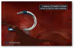 Sensei® Robotic Catheter System Does Heart Surgery at Scripps in San ...